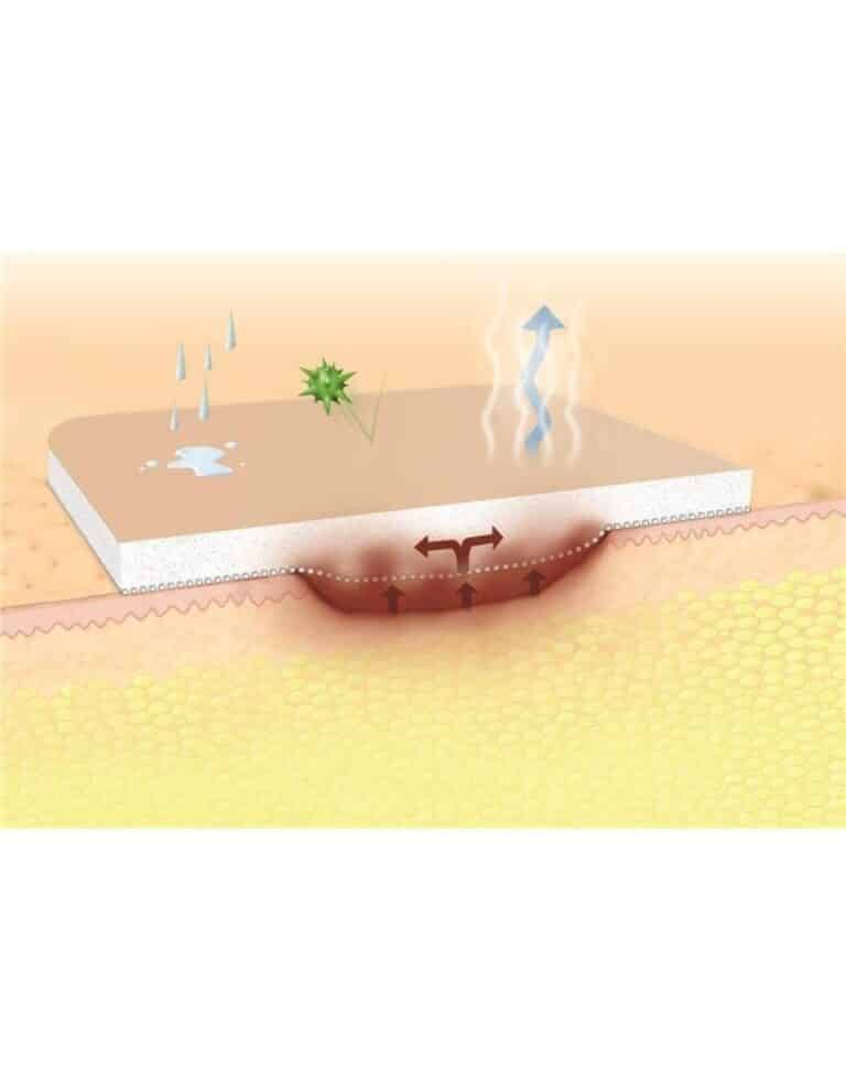 Apósito transparente I.V. reforzado – Oper Film Protect IV